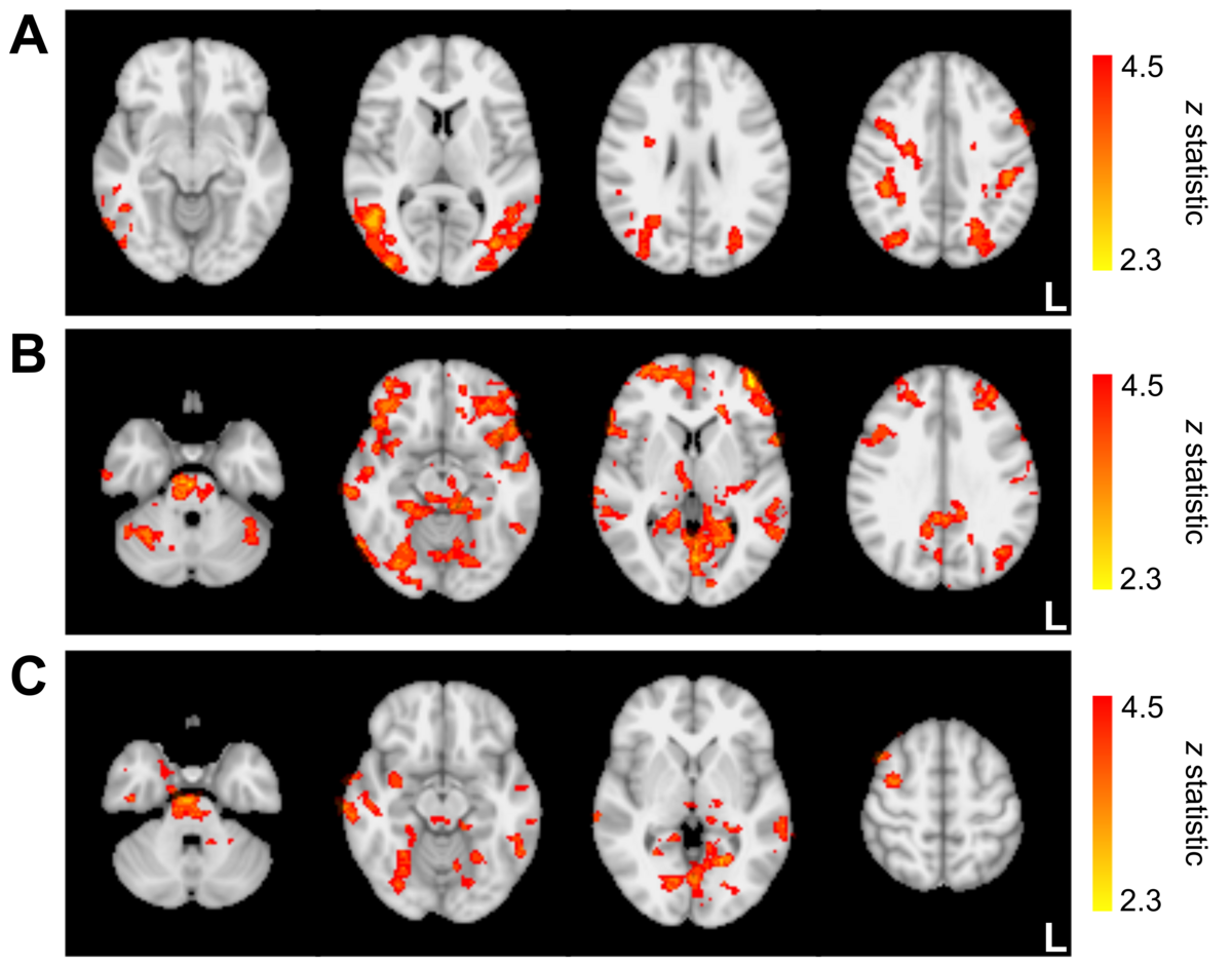 Hemodynamic Response to Hypoxia | College of Engineering and Computer Science
